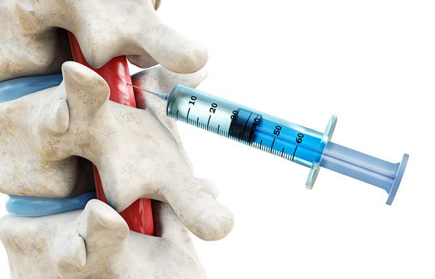 Injectable Therapy Shows Promise For Tissue Repair After Severe Spinal ...