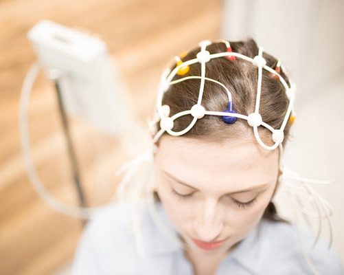 An Electrode Implanted In The Brain Could Help Improve Memory Function ...