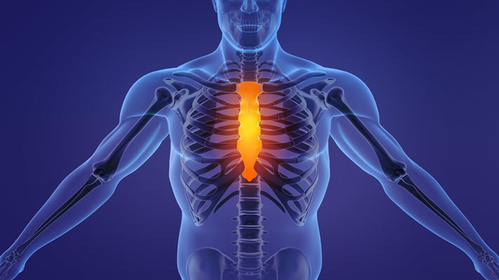 Sternum Fractures, A Painful But Often Diagnosed Accidental Injury